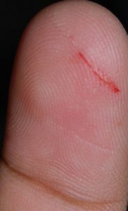 The Ultimate Guide To Red Light Therapy And Near-Infrared Light Therapy ...